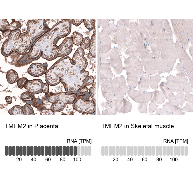 - HPA044889 - Atlas Antibodies CEMIP2 antibody | Antibodypedia