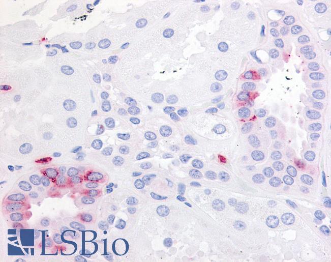 - LS-A104956 - LSBio PTGER2 antibody | Antibodypedia