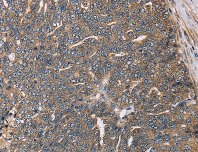 - LS-C401748 - LSBio HSD17B12 antibody | Antibodypedia