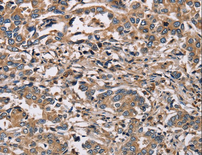 - LS-C401748 - LSBio HSD17B12 antibody | Antibodypedia