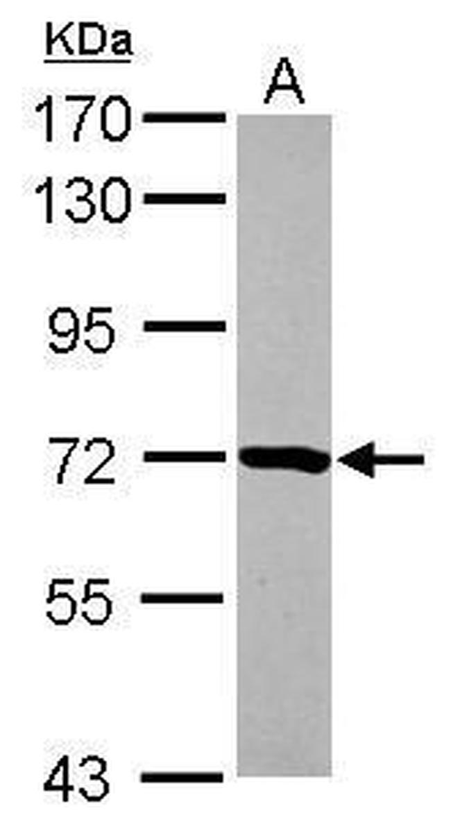 - PA5-78323 - Invitrogen Antibodies PRMT5 antibody | Antibodypedia