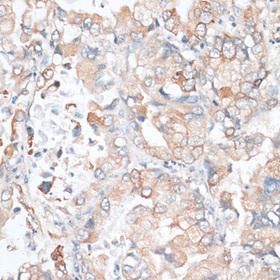 - LS-C749723 - LSBio HMGCR antibody | Antibodypedia