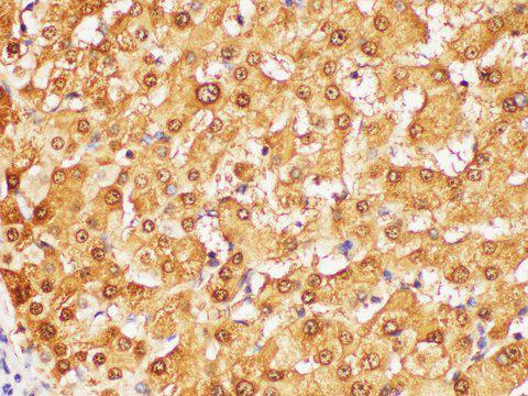 - LS-C831554 - LSBio GSTA1 antibody | Antibodypedia