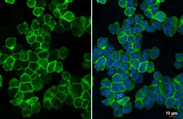 - MA5-47164 - Invitrogen Antibodies TREM2 antibody | Antibodypedia