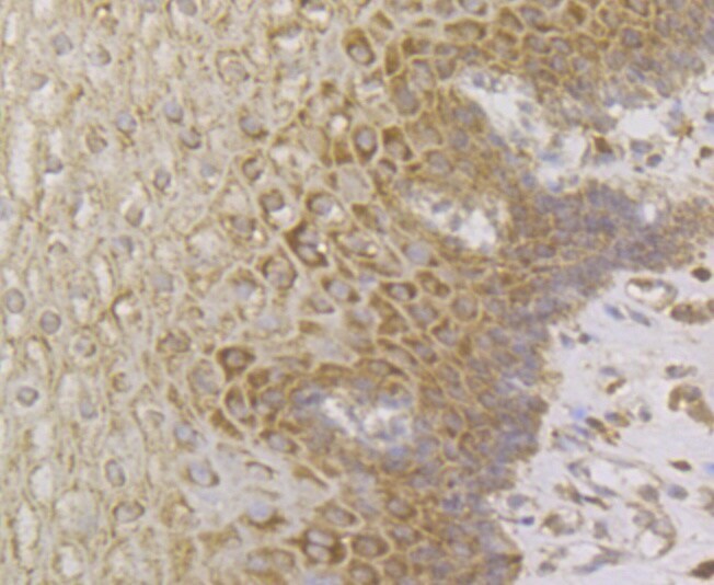 - PA5-109315 - Invitrogen Antibodies PRF1 antibody | Antibodypedia