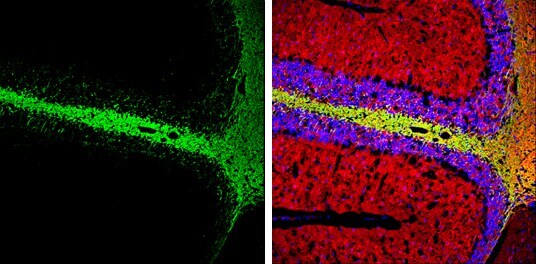 - PA5-78397 - Invitrogen Antibodies MBP antibody | Antibodypedia