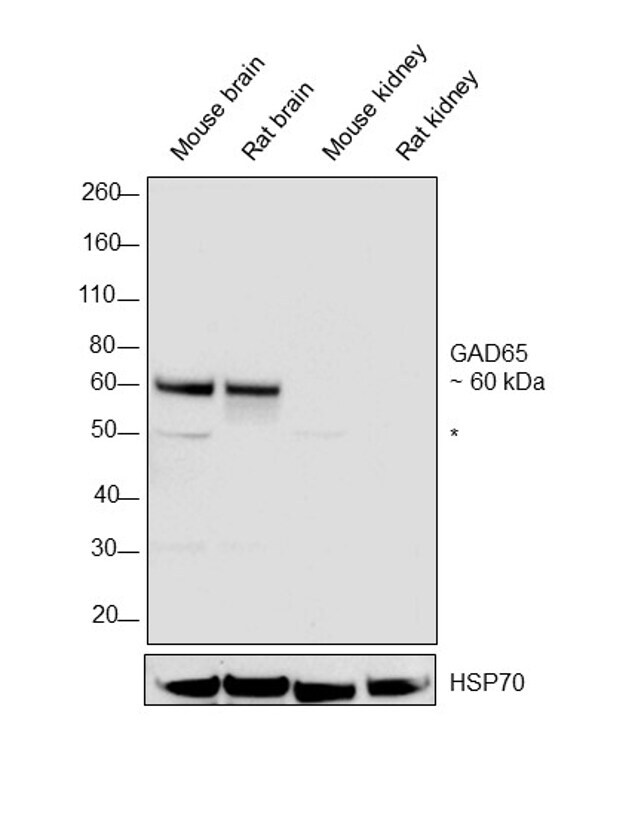 - PA5-21297 - Invitrogen Antibodies GAD2 antibody | Antibodypedia