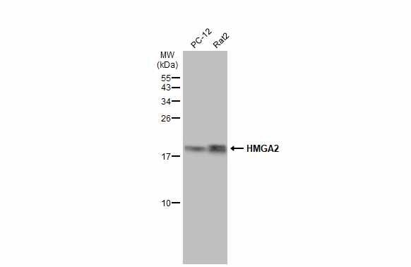 - PA5-21320 - Invitrogen Antibodies HMGA2 antibody | Antibodypedia