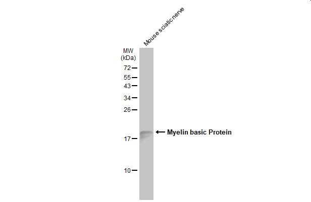 - PA5-78397 - Invitrogen Antibodies MBP antibody | Antibodypedia