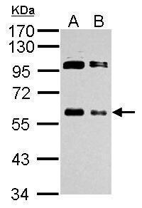 - PA5-85185 - Invitrogen Antibodies MYC antibody | Antibodypedia