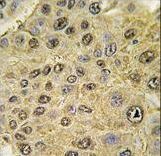 - LS-C96684 - LSBio HIF1A antibody | Antibodypedia