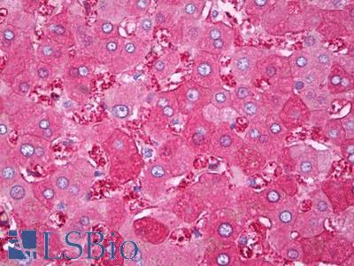 - LS-B7139 - LSBio FTH1 antibody | Antibodypedia