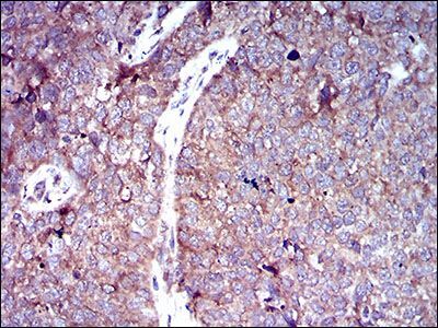 - LS-C759710 - LSBio SLC2A4 antibody | Antibodypedia