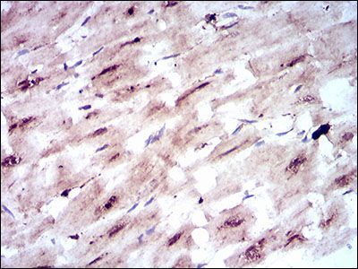 - LS-C759710 - LSBio SLC2A4 antibody | Antibodypedia