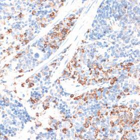 - LS-C749723 - LSBio HMGCR antibody | Antibodypedia
