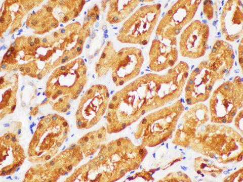 - LS-C831554 - LSBio GSTA1 antibody | Antibodypedia